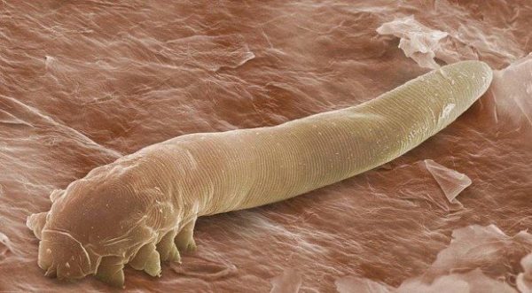 Demodex mites under the microscope | Ungex - Ungex | Demodex treatment
