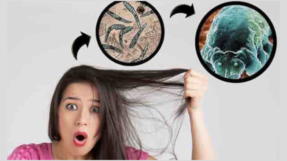 Ways to Get rid of Demodex mites | Ungex - Ungex | Demodex treatment