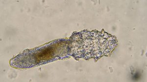 Demodex Mites Under The Microscope - Ungex | Demodex treatment