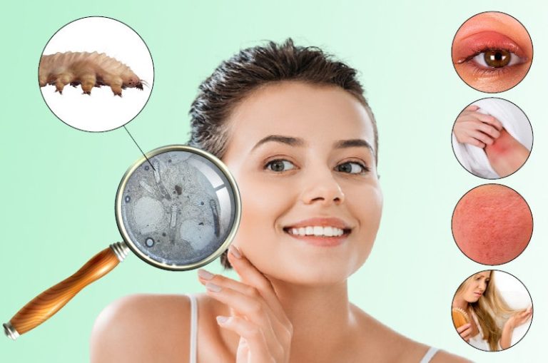 All about Demodex mites | Ungex Demodex Treatment
