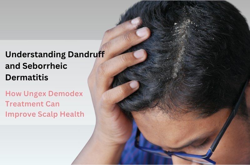 Demodex Hair Mites | Ungex Blog