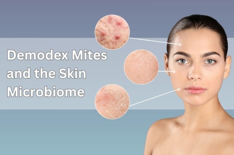 Demodex Mites, Skin Microbiome and Your Skin Barrier
