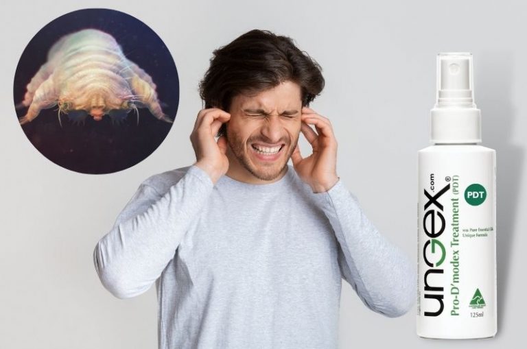 Ear Mites In Humans Kinds Signs Prevention And Remedy Ungex