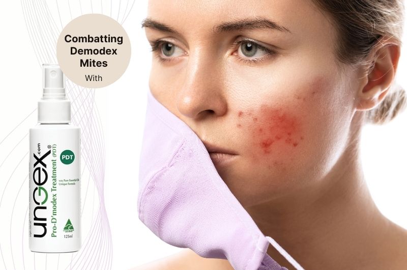 Combatting Demodex Mites with Ungex PDT Spray - Global Ungex's Website