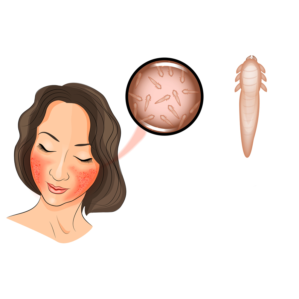 Ungex Solutions | Best Demodex Treatment For Human Mites