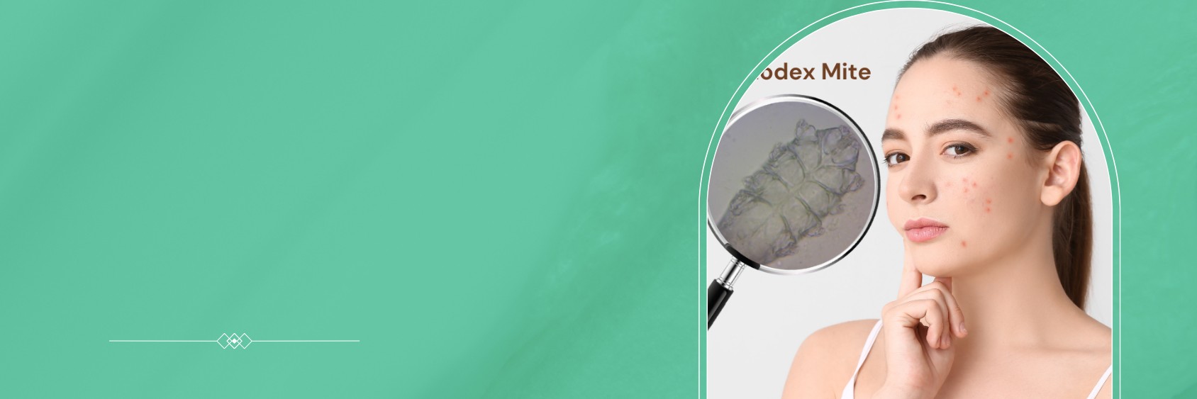 Demodex Mites: Causes, Symptoms, and Treatment Options for Skin and ...