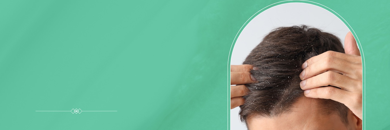 How Demodex Mites Influence Dandruff and Seborrheic Dermatitis ...